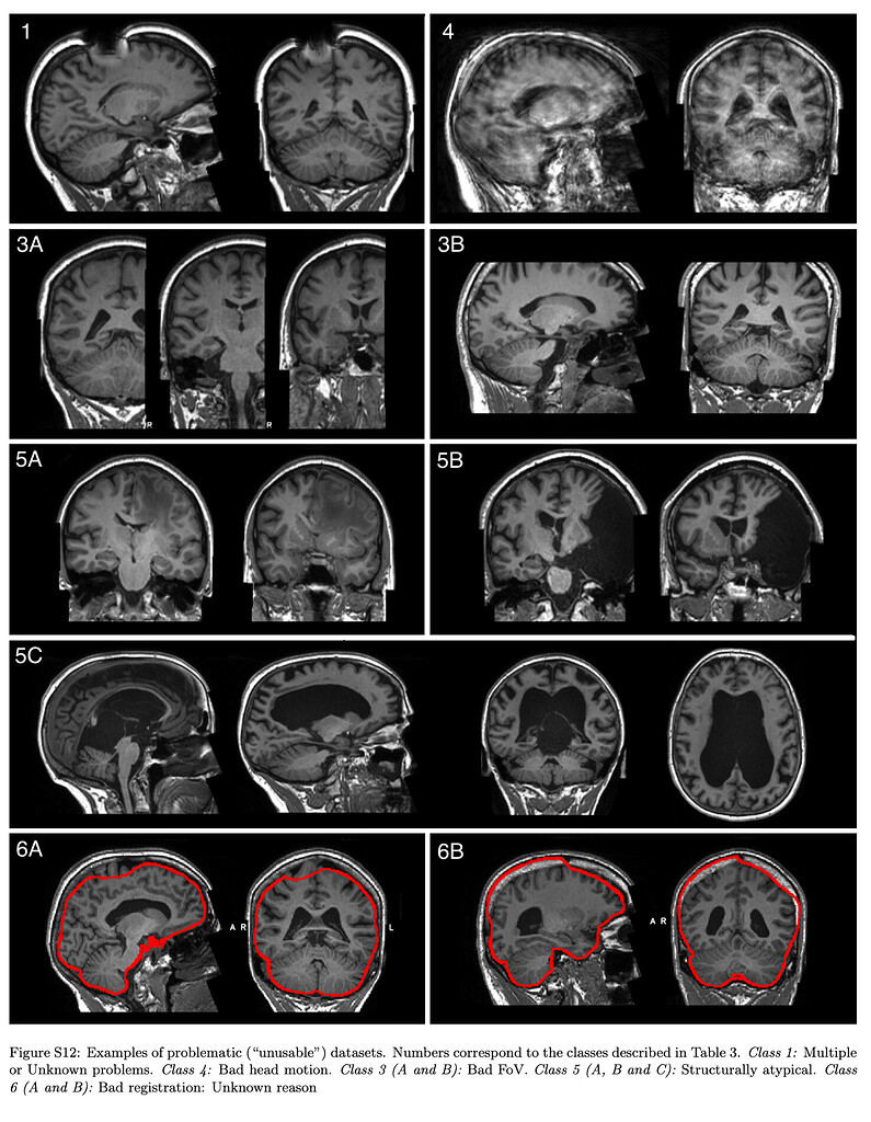 MRI Quality Control - Deep Learning - fast.ai Course Forums