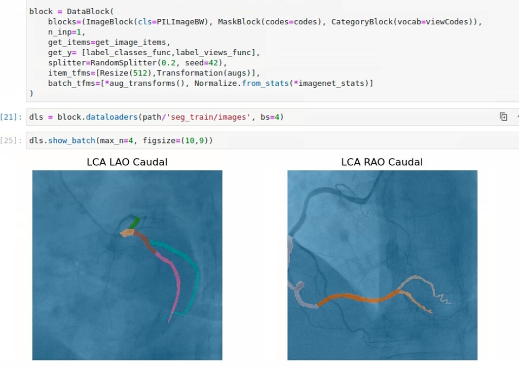 Specifying n_out of unet_learner for multi-target mask + category prediction - fastai - fast.ai ...